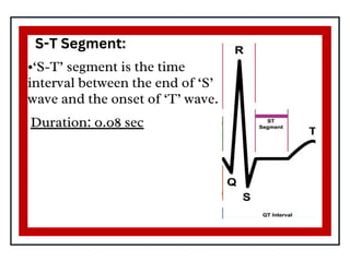 Electrocardiogram_20240614_173859_0000.pdf