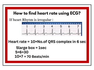 Electrocardiogram_20240614_173859_0000.pdf