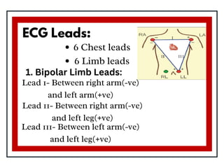 Electrocardiogram_20240614_173859_0000.pdf