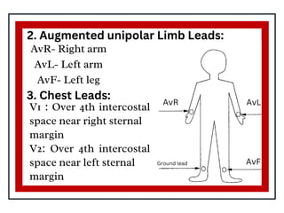 Electrocardiogram_20240614_173859_0000.pdf