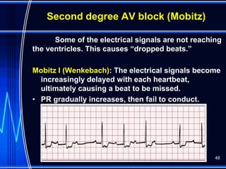 Electrocardiogram 2554 | PDF