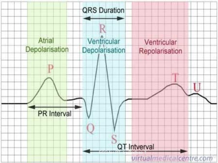Electrocardiogram 2554