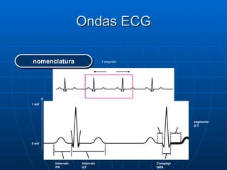 Electrocardiograma | PPT