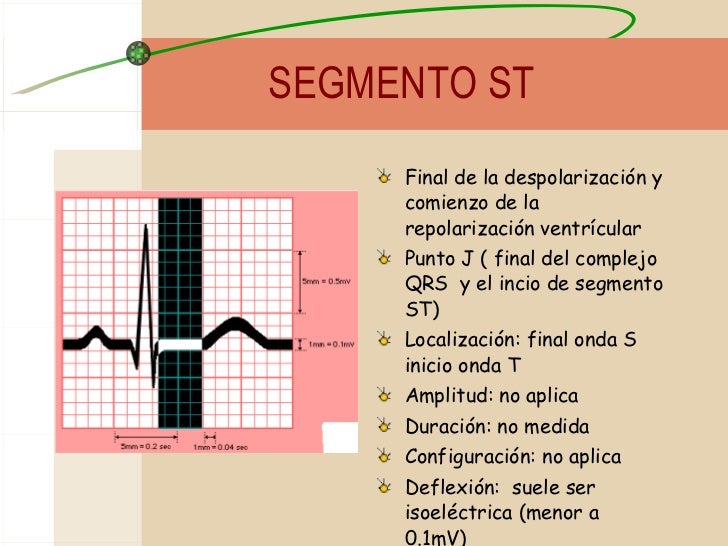 Electrocardiograma