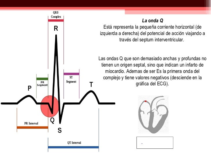 Electrocardiograma