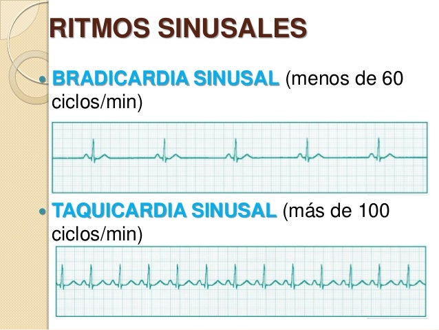 Electrocardiograma