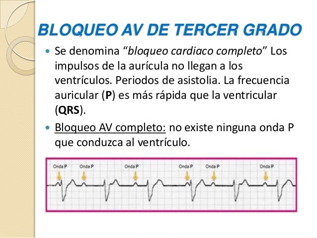 Electrocardiograma