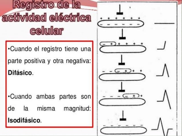 Electrocardiograma electrocardiograma