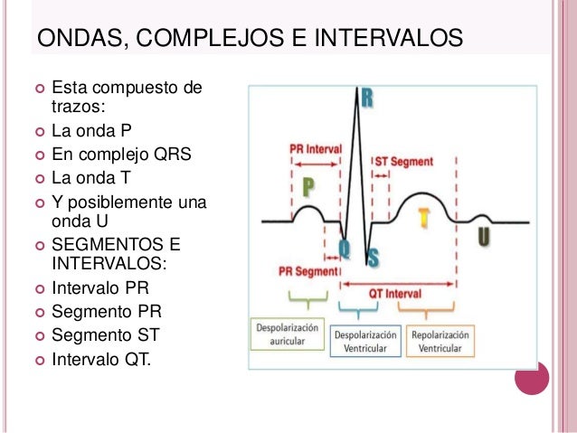 Electrocardiograma Ondas