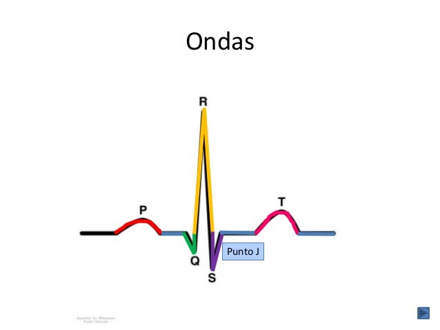 Electrocardiograma Ondas