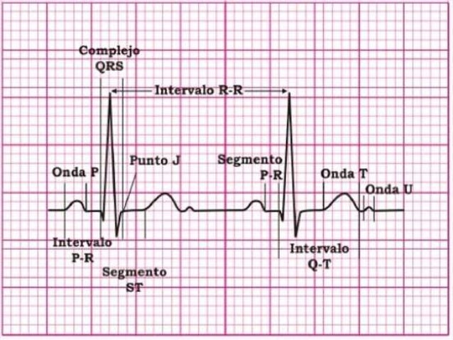 MÉTODO DEL DR. DUBIN PARA LA INTERPRETACIÓN DE ECG | Medicina Interna ...