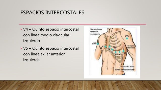 Electrocardiograma
