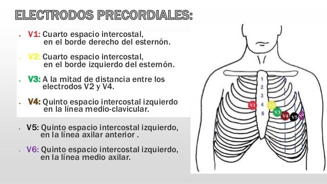 Electrocardiograma