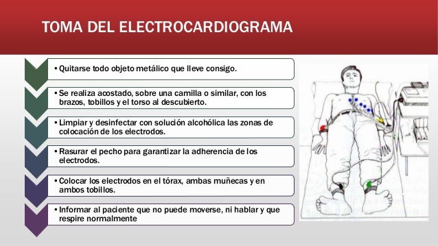 Electrocardiograma