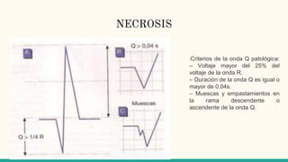 Electrocardiograma - Interpretación clínica y patologías | PPT