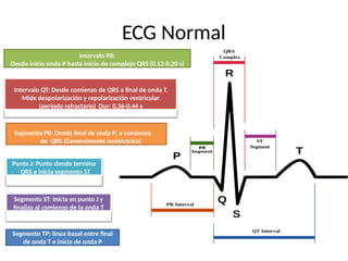 Electrocardiograma interpretación ya analisis.pptx