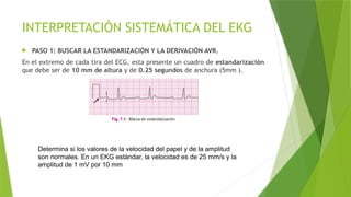 ELECTROCARDIOGRAMA NORMAL CON SUS DERIVACIONES | PPTX