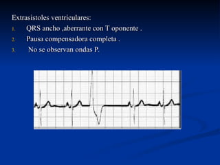 Aprende electrocardiograma facil - electrocardiograma basico | PPT