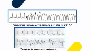 Taquicardias QRS ancho.pptx