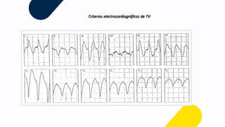 Taquicardias QRS ancho.pptx
