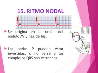 Electrocardiograma anormal