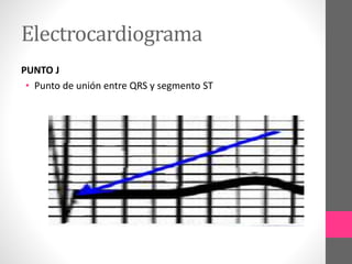 Electrocardiograma ariana | PPTX