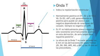 Electrocardiograma Basica | PPT