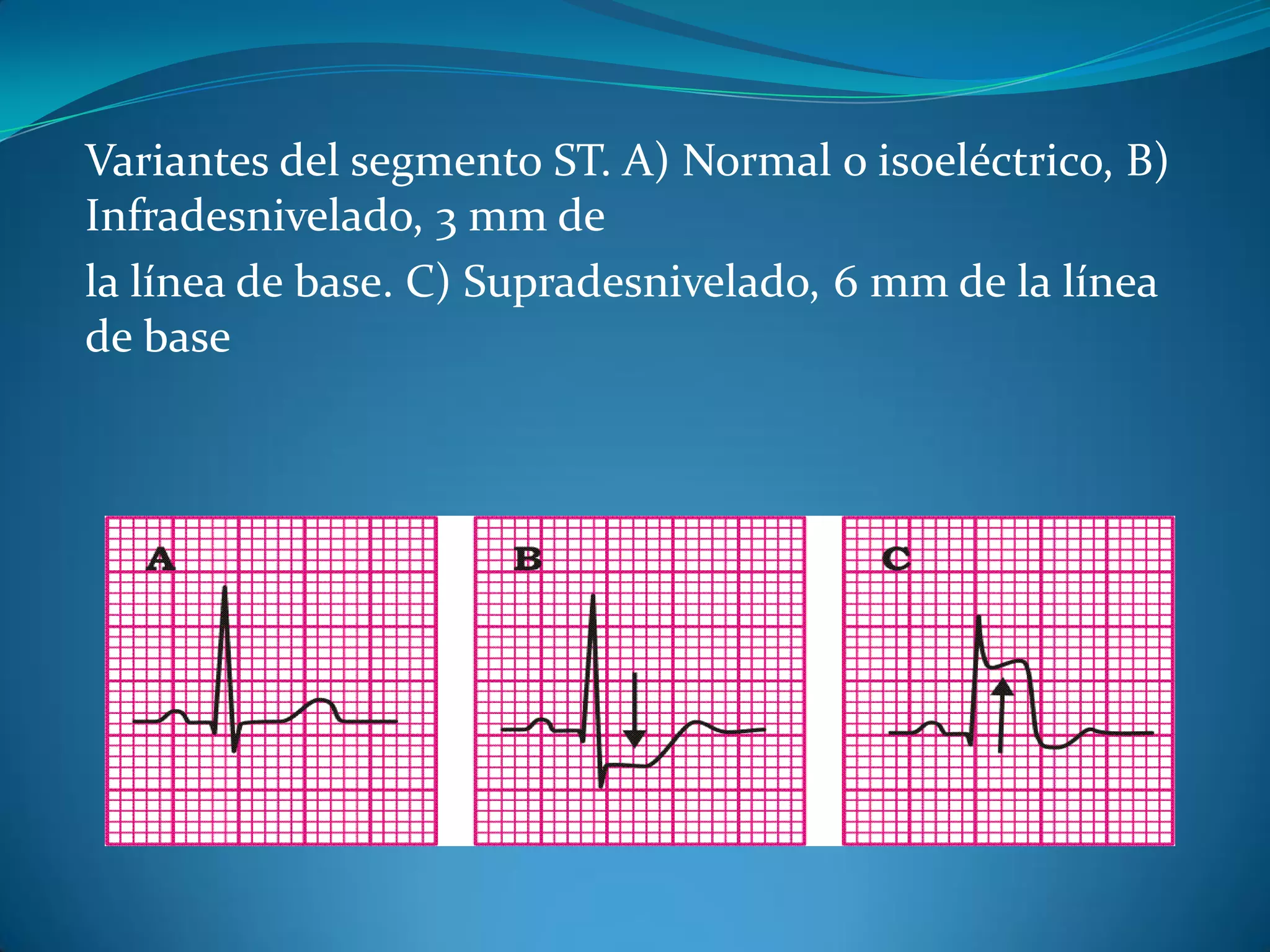 Electrocardiograma normal | PDF