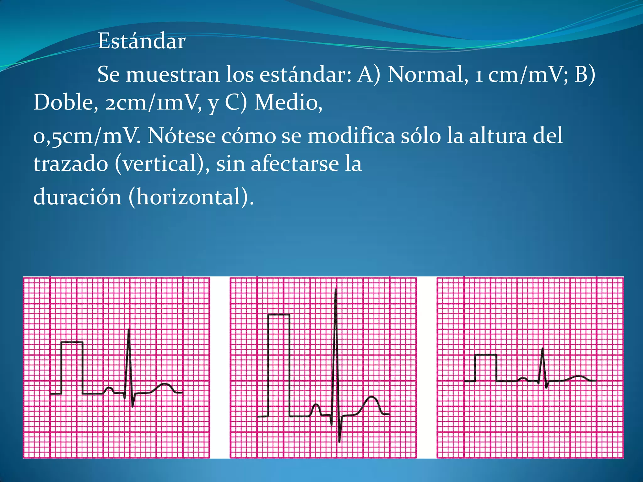 Electrocardiograma normal | PDF