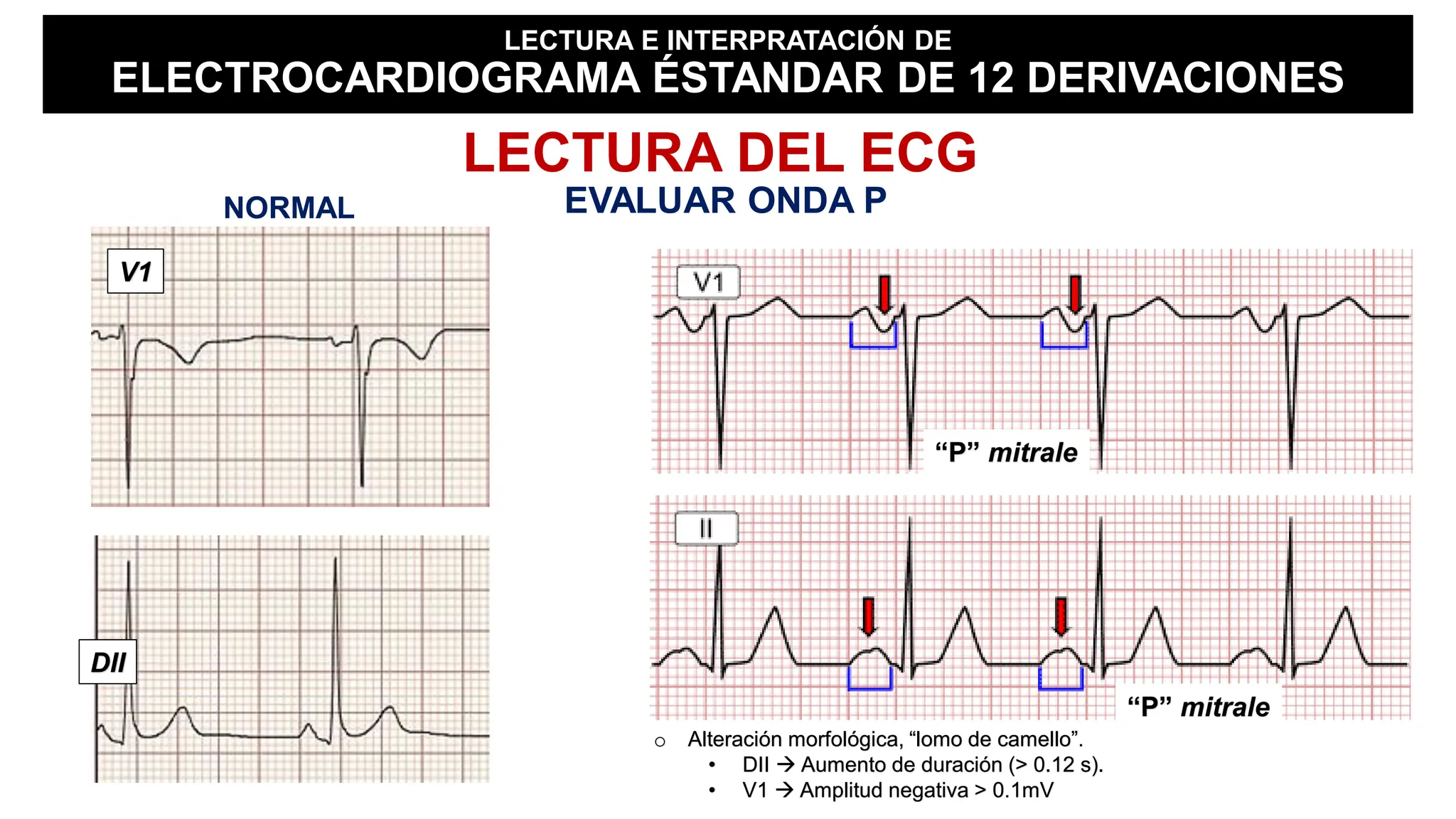 ELECTROCARDIOGRAMA completo (1).pdf cardiologia | PDF