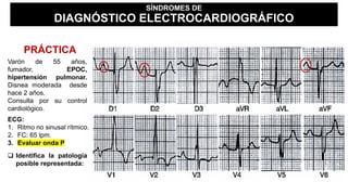 ELECTROCARDIOGRAMA completo (1).pdf cardiologia | PDF