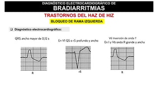 ELECTROCARDIOGRAMA completo (1).pdf cardiologia | PDF