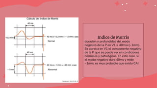 Electrocardiograma Crecimientos | PPTX