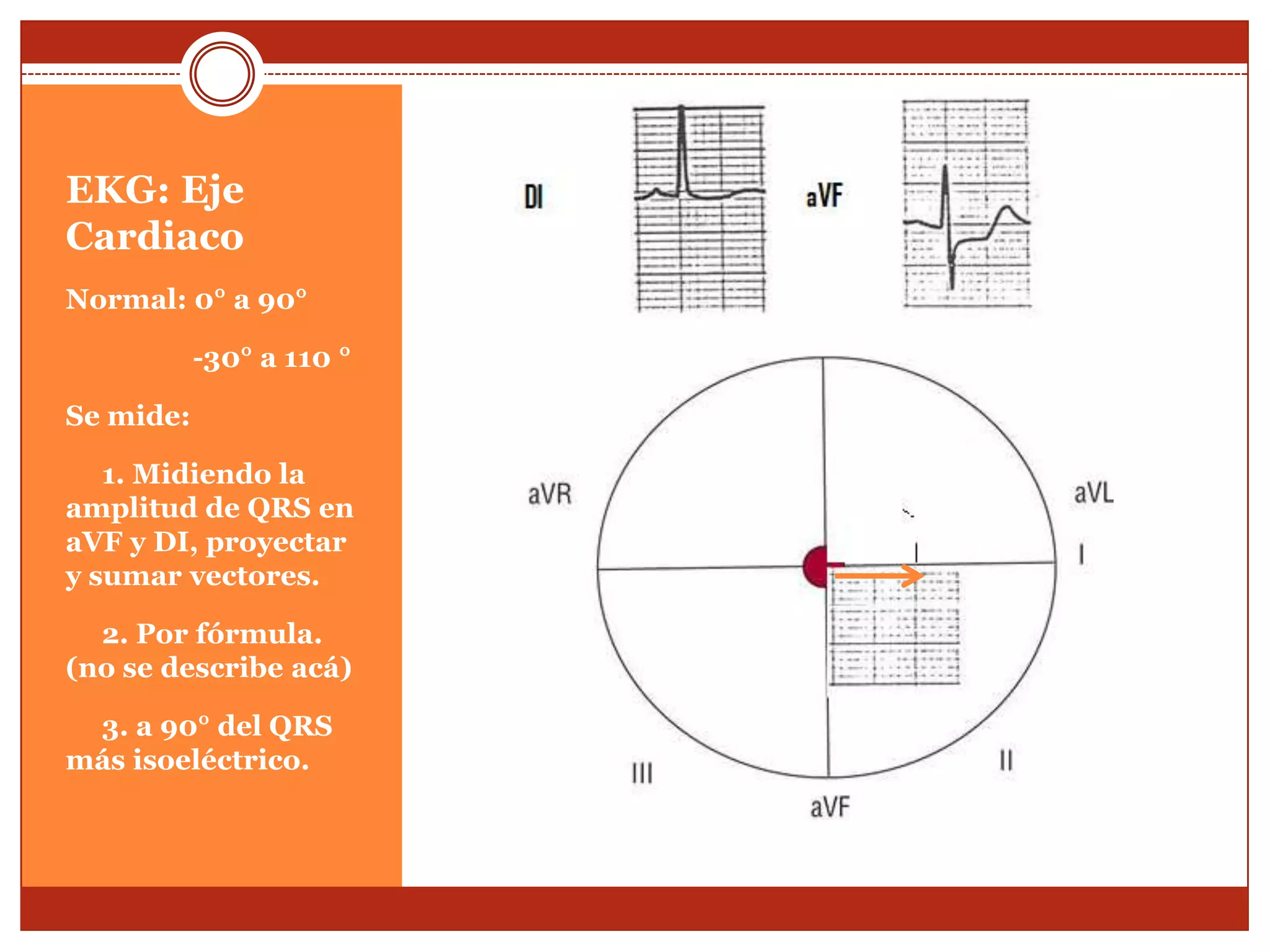 Electrocardiograma (ekg) | PPTX