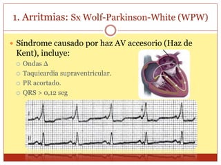 Electrocardiograma (ekg) | PPTX