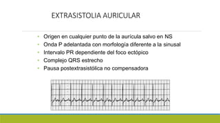 Electrocardiograma Exposición 2018 | PPTX