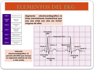 ELECTROCARDIOGRAMA laminas lectura de ekgpptx | PPTX