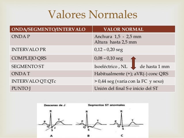 Electrocardiograma normal