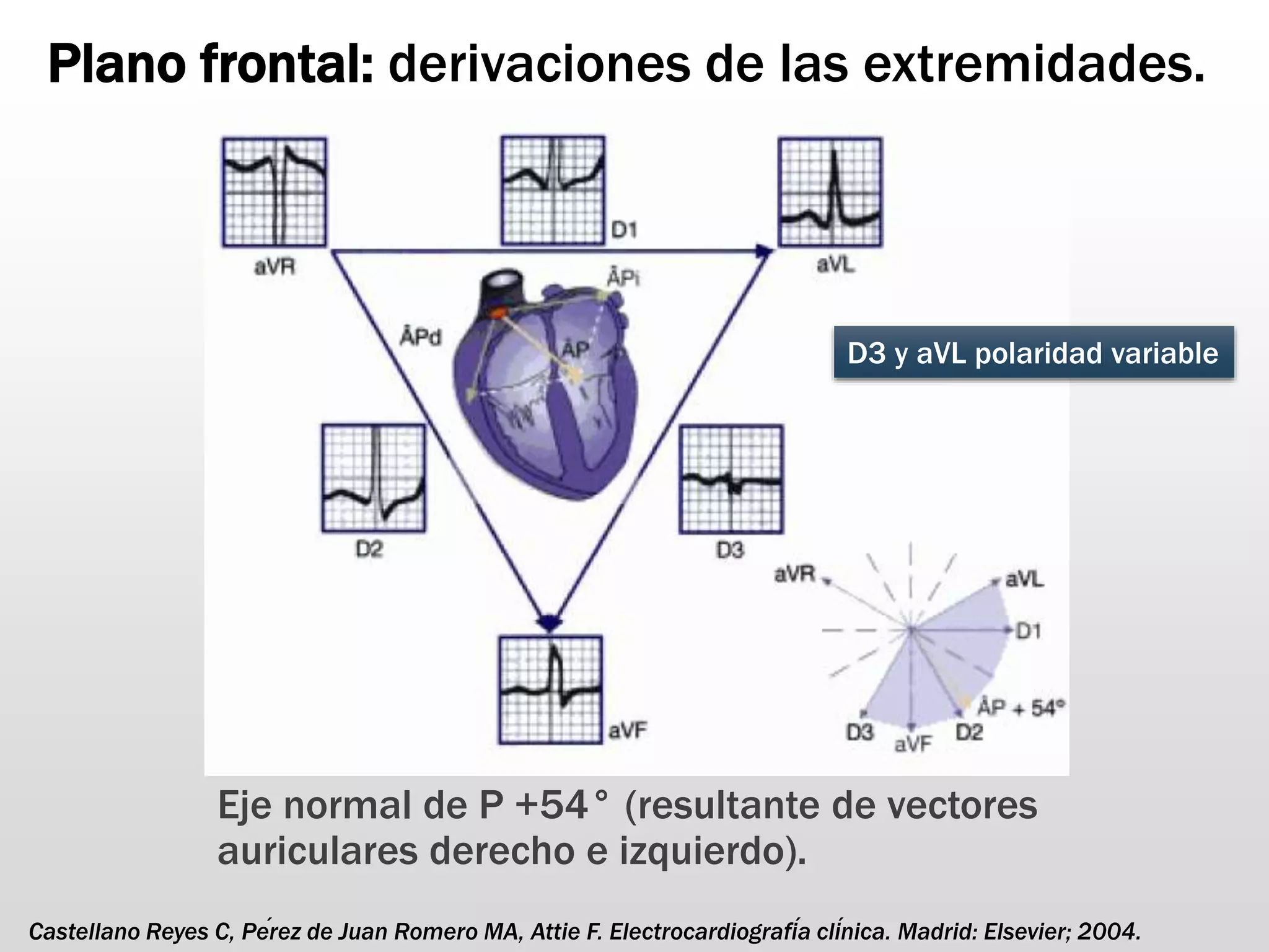 Electrocardiograma normal. cuitlahuac arroyo. r1 cardiología | PPTX