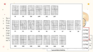Electrocardiograma normal.pptx