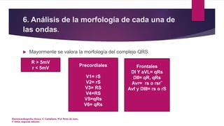 Electrocardiograma normal.pptx