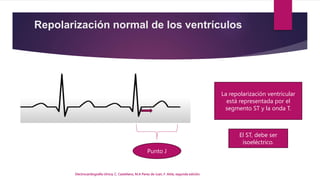 Electrocardiograma normal.pptx