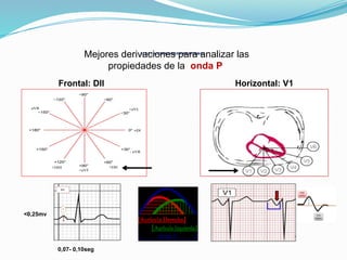 ELECTROCARDIOGRAMA NORMAL y su Interpretacion | PPTX