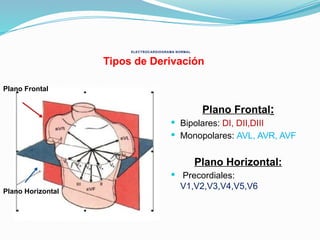 ELECTROCARDIOGRAMA NORMAL y su Interpretacion | PPTX