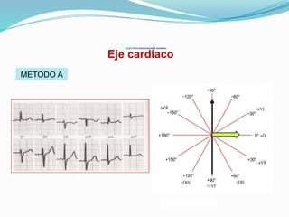 ELECTROCARDIOGRAMA NORMAL y su Interpretacion | PPTX