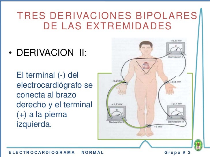 CAPITULO 11: ELECTROCARDIOGRAMA NORMAL. – El blog de Hannia Ruiz