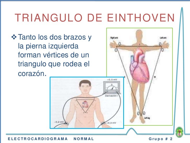 CAPITULO 11: ELECTROCARDIOGRAMA NORMAL. – El blog de Hannia Ruiz