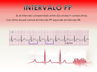 ELECTROCARDIOGRAMA NORMAL | PPTX