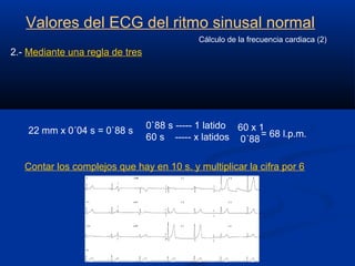 Electrocardiograma normal wab | PPT