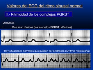 Electrocardiograma normal wab | PPT